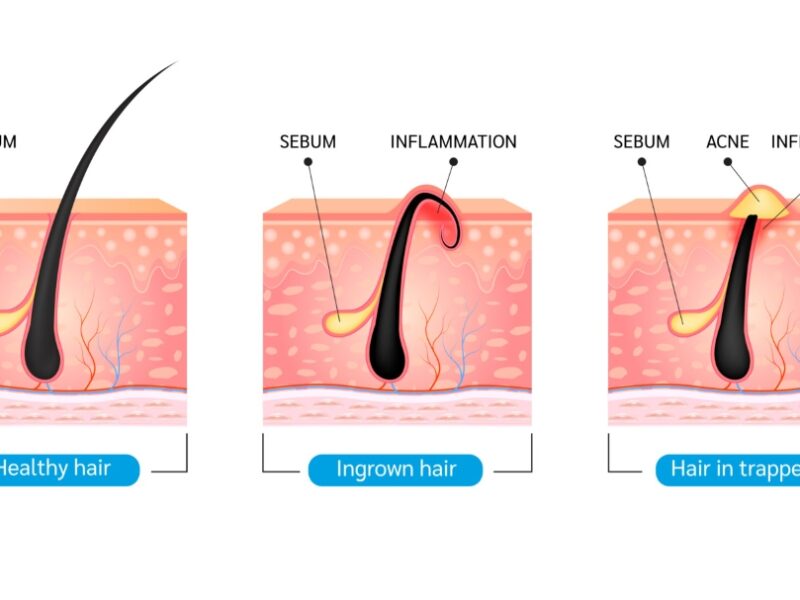 How to Clean Your Penis the Right Way